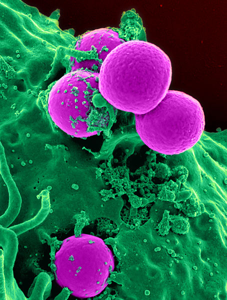 Beware of the Superbugs! | Prairie View Animal Hospital